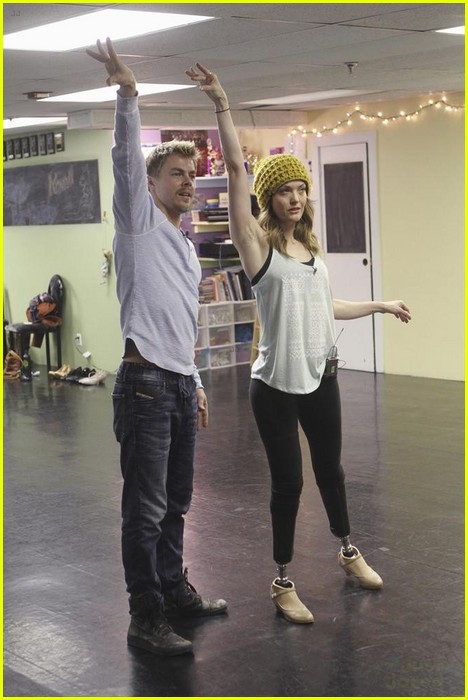 Amy Purdy Shares Personal Story Ahead of DWTS Premiere with Derek Hough ...