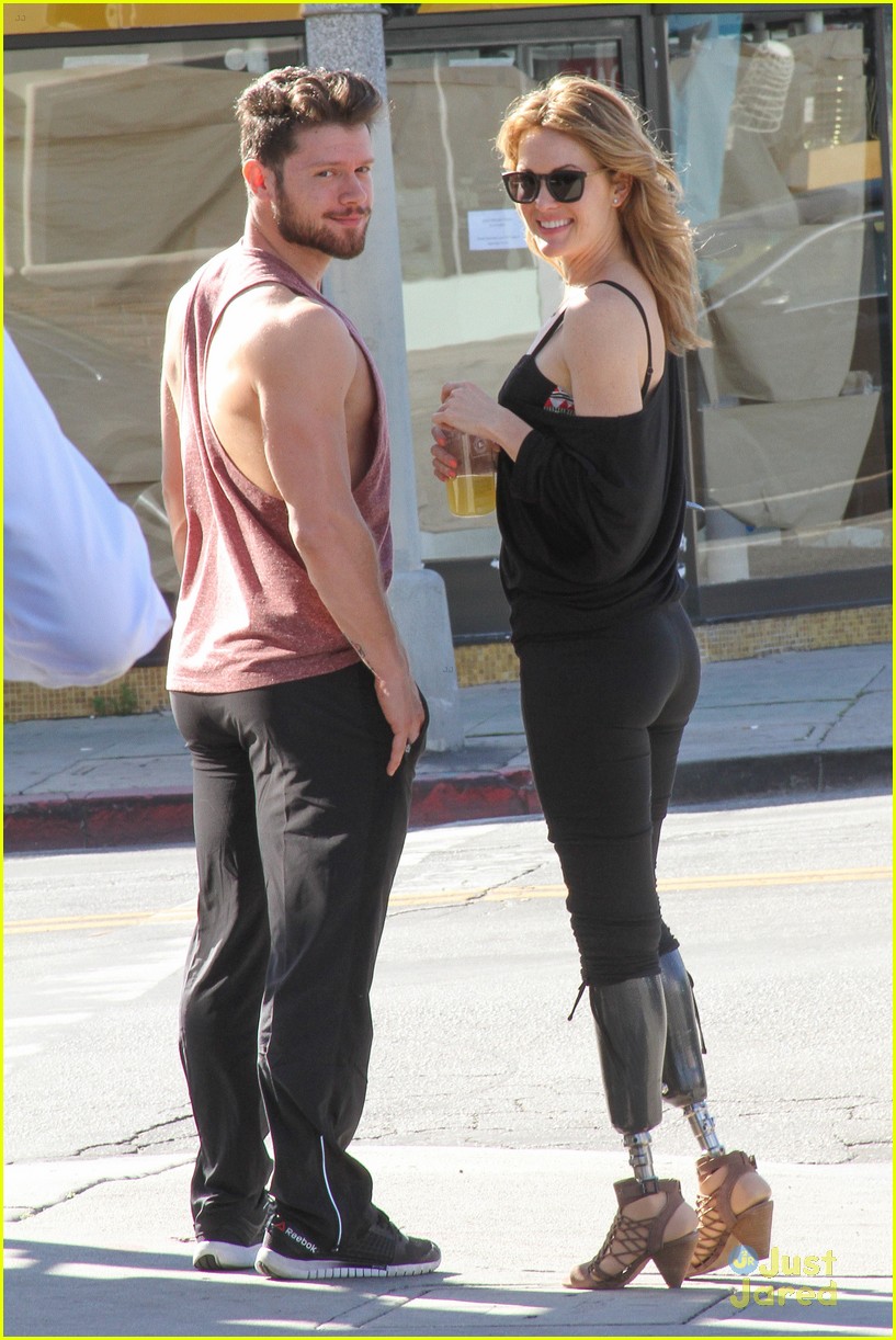 Amy Purdy Puts On Her Dancing Legs With Henry Byalikov | Photo 782990 ...