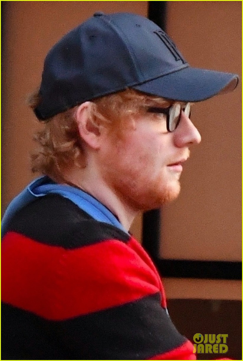 Ed Sheeran Gets Creative With His New Cast - See the Pics! | Photo ...