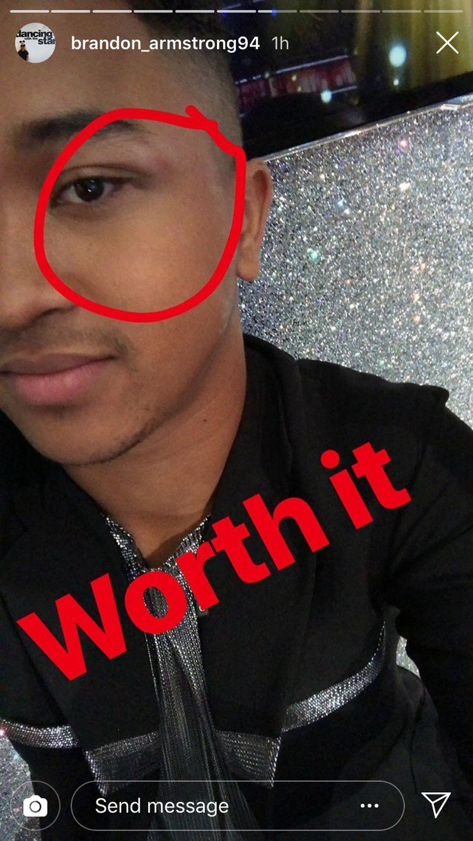 Tinashe Gave Brandon Armstrong A Black Eye After Their Stunning ...
