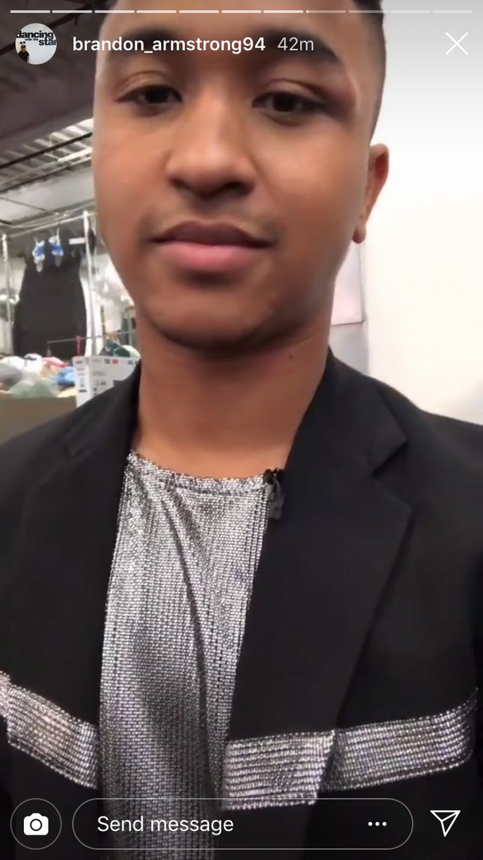 Tinashe Gave Brandon Armstrong A Black Eye After Their Stunning ...