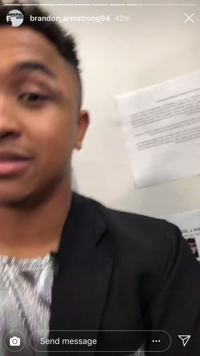 Tinashe Gave Brandon Armstrong A Black Eye After Their Stunning ...