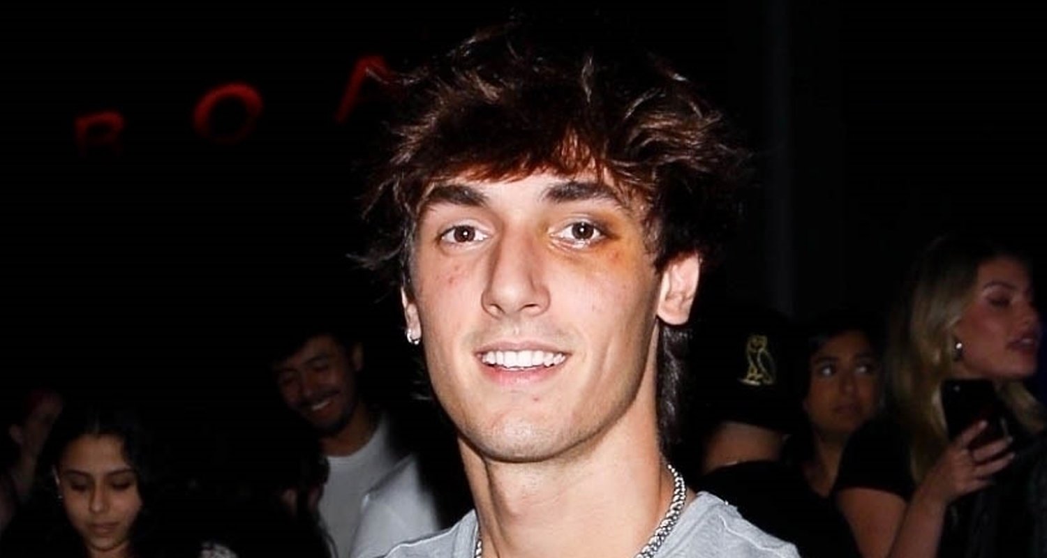 Bryce Hall Shows Off His Bruised Eye While Out With Friends After ...